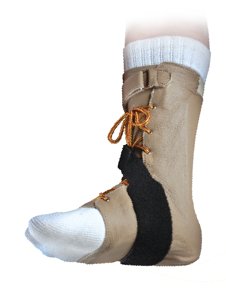 Richie Brace Gauntlet - The Richie Brace